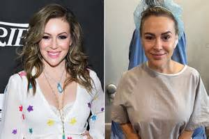 Alyssa Milano Says Shes Getting Her Breast Implants Removed