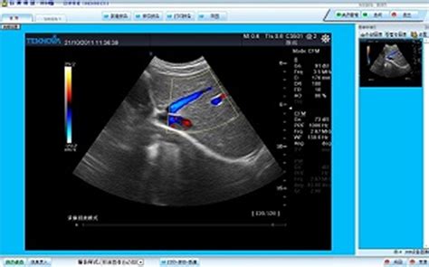 超声影像工作站