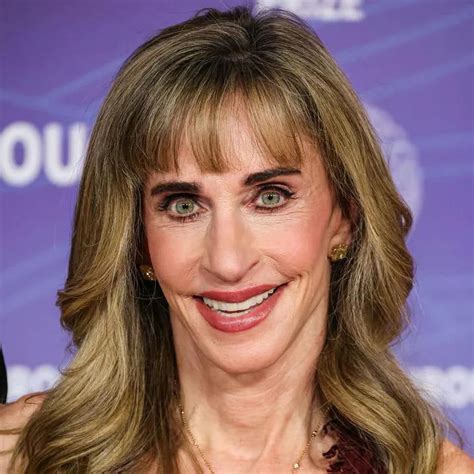 People Are Sad And Concerned Over Susan Dells Before And After