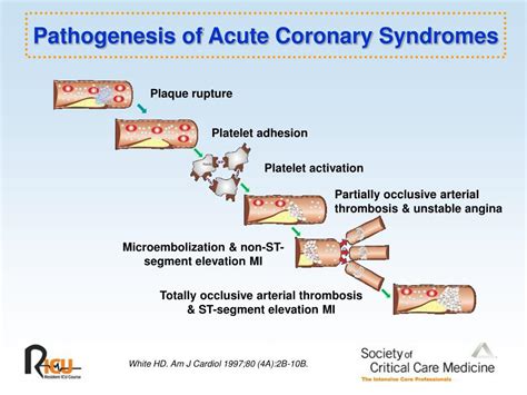 Ppt Inadequate Tissue Perfusion Resulting From Cardiac Dysfunction