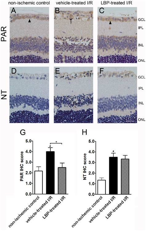 LBP Pre Treatment Lowered Lipid Peroxidation But Not Nitrosative Stress Download Scientific