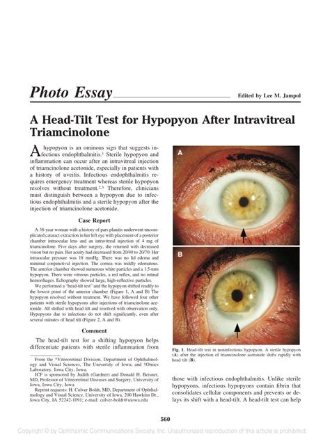 Pdf A Head Tilt Test For Hypopyon After Intravitreal Triamcinolone