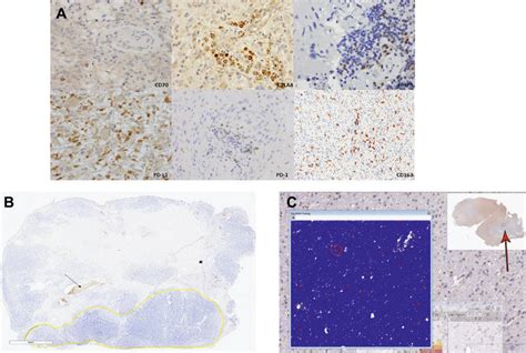 examples of ihc staining and aperio analysis a representations of