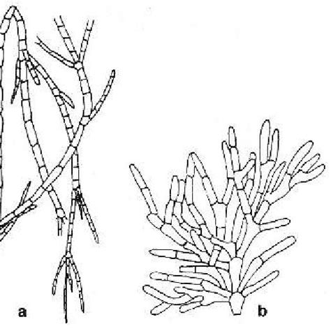 A C — Thiothrix Nivea A B — 1000 X C — 60 X D — Thiothrix