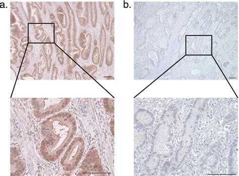 Representative Images Of The Differential Staining Intensities Of Download Scientific Diagram