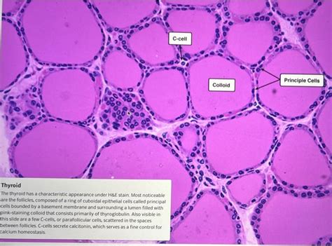Solved Examining The Microscopic Structure Of The Thyroid