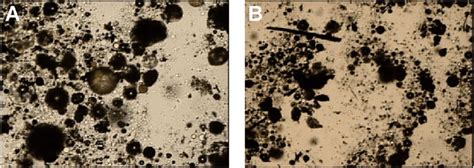 Microscopic Image Of The Tested Fly Ash Light Passing Through One Download Scientific Diagram