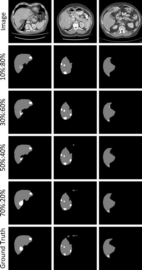 The Segmentation Results Under Different Ratios Of The Size Between