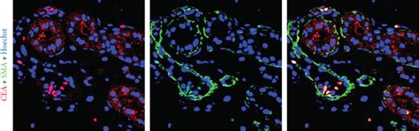Histomorphology Immunocytochemical Analysis And Ultrastructure Of