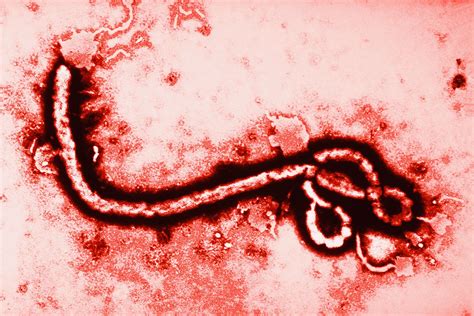 Qué Es El ébola Cómo Se Transmite Y Por Qué Es Tan Mortal Rtve