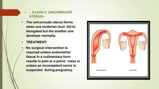 Uterine Abnormality Pptx