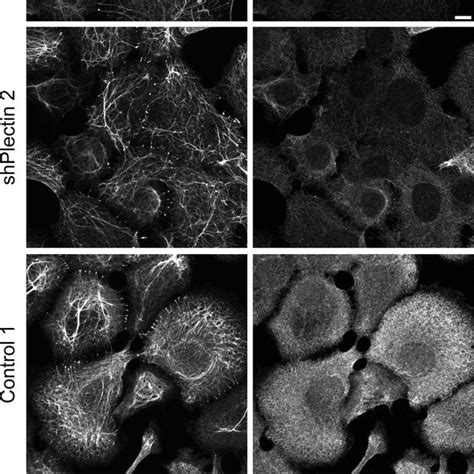 Plectin Knock Down Prevents Formation Of Integrin β4 Clusters And