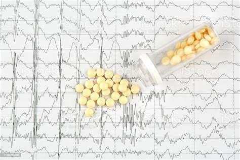 Ekg 그래프에 노란색 알약과 유리병의 클로즈업 사진 0명에 대한 스톡 사진 및 기타 이미지 0명 감기와 독감 개체 그룹