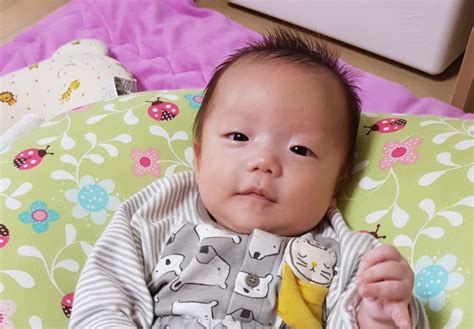 아기 땀띠 증상 원인 대처법 로션 수딩젤 네이버 블로그