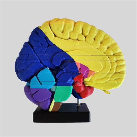 Cerebral Vascular Territories Model By Dan Man Md Makerworld
