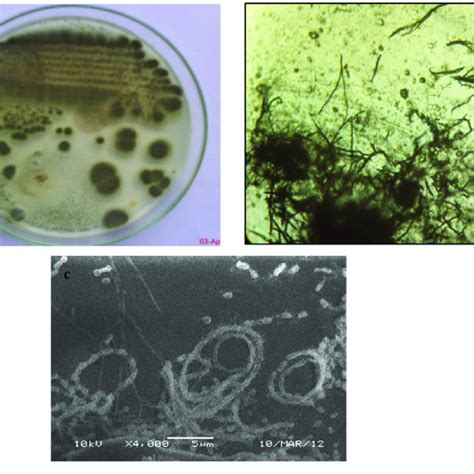 Pdf Antifungal Activity Of Streptomyces Sp Slr03 Against Tea Fungal Plant Pathogen