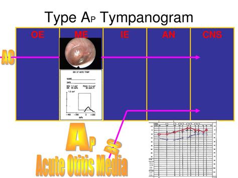 Ppt Electrophysiological Measures Of The Auditory System Powerpoint