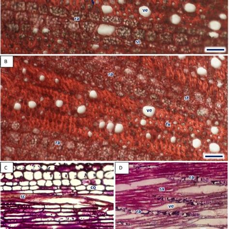 Longitudinal Radial A Sections Of The Root Neck Radial Section Of