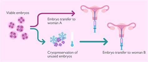 Donating Surplus Ivf Embryos To Other Couples Invitra Egg And Sperm