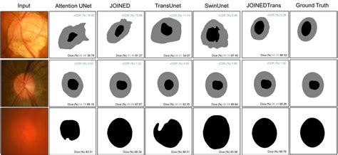 Representative Segmentation Results From Different Automated Methods