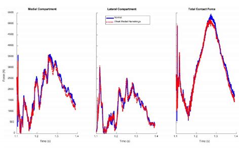 Effect Of Medial Hamstring Weakness On Cartilage Contact Forces The