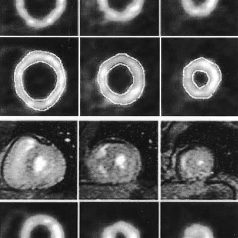 Example Of Model Based Parameter Estimation In Patient With Large Download Scientific Diagram