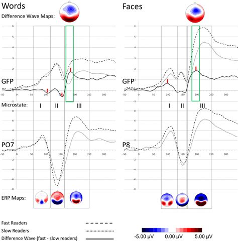 Grand Average Waveforms And Scalp Maps The Upper Panel Shows Global