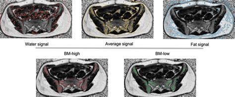 schematic diagram of abm segmentation download scientific diagram