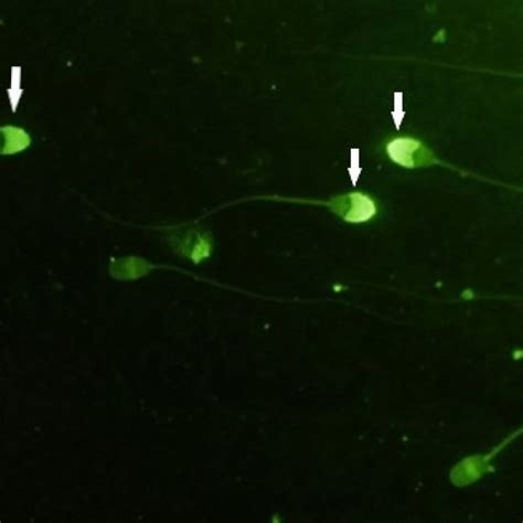 Example Of Spermatozoa As Evaluated For Acrosome Integrity Sperm That Download Scientific