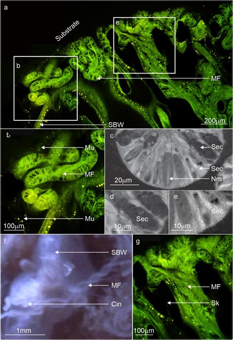 Confocal Fluorescence Microscopy Images Backscatter Electron