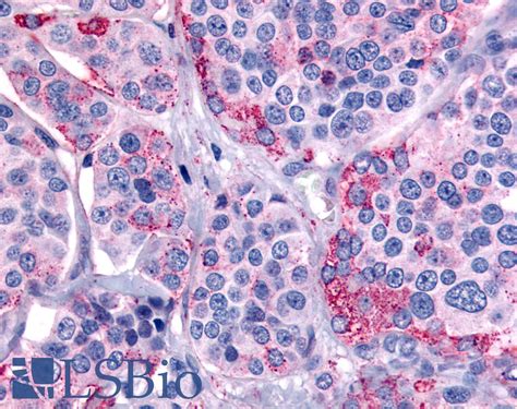 Pathplus™ Calcr Calcitonin Receptor Polyclonal Antibody Rabbit Lsbio
