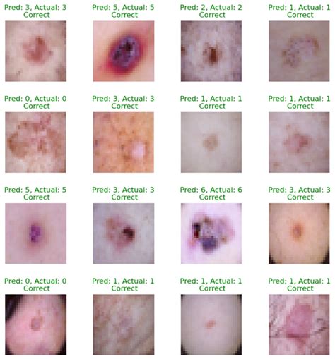 Efficient Harris Hawk Optimization Hho Based Framework For Accurate Skin Cancer Prediction