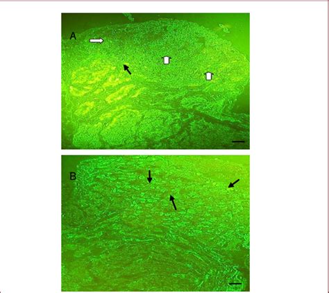 Ephrin A2 Expression In Frozen Sections Of The Acoustic Ganglia From A