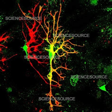 Brain Nerve Cells Light Micrograph Stock Image Science Source Images