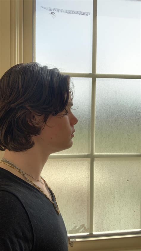 How Bad Is Non Mewing Side Profile R Mewing