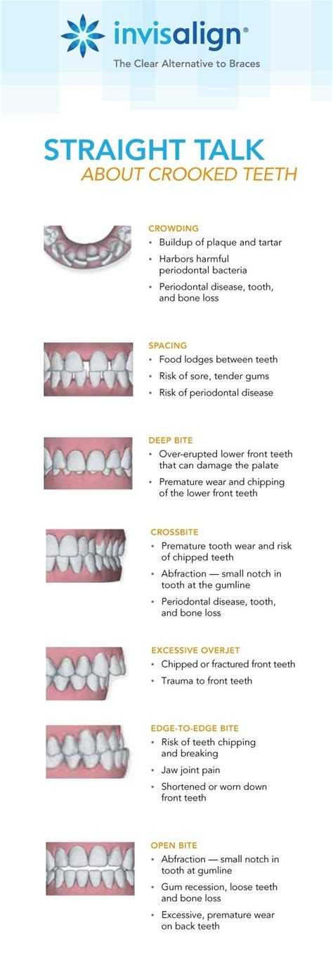 Types Of Malocclusion