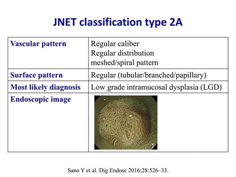 Jnet Classification Of Colo Rectal Polyps