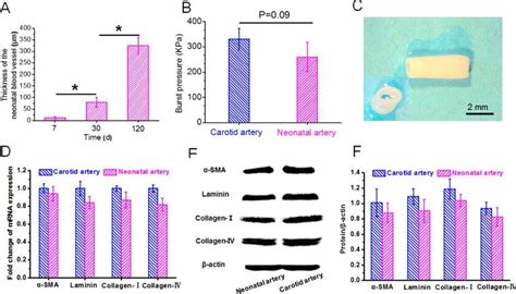 A Thickness Of The New Tissue In The Multilayered Shape Memory Download Scientific Diagram