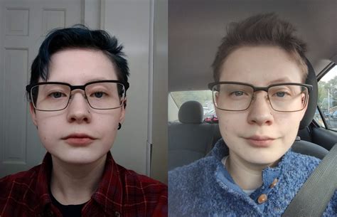 2 Weeks Pre T Vs 7 Months On T Rtranstimelines