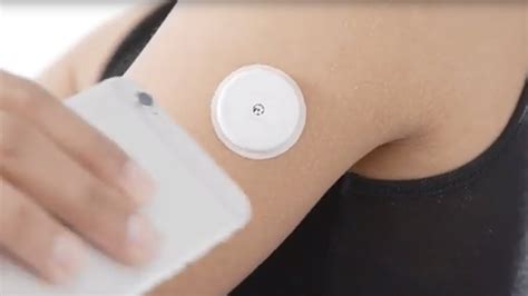 Applying Freestyle Libre Sensor My Xxx Hot Girl