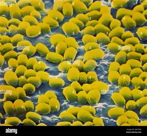 Bacillus Anthracis Spores Coloured Scanning Electron Micrograph Sem