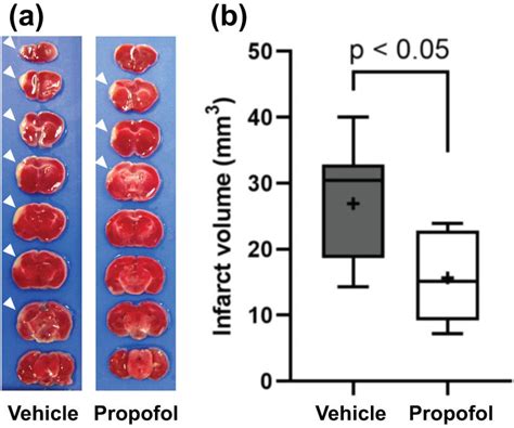 Effect Of Propofol Pretreatment On Infarct Volume A Staining For Download Scientific Diagram