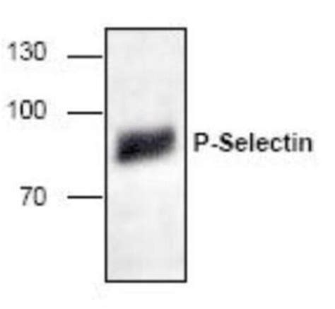 P Selectincd62p Antibody Novus Biologicalsantibodiesprimary