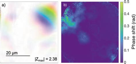 Iucr Qu­antitative Phase Measurements Of Human Cell Nuclei Using X Ray Ptychography