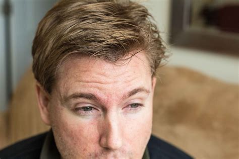 How To Get Rid Of Your Deep Forehead Wrinkles