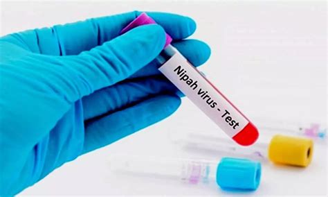 Nipah Can Spread By Droplets Has A Fatality Rate Of 40 To 70 Icmr