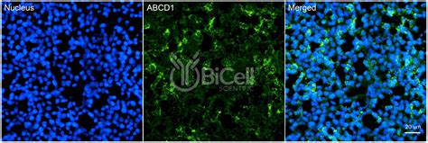 Abcd1 Antibody Bicell Scientific®