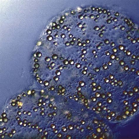 Pdf Plasmid Curing Assay In Clinical Isolates Of Antibiotic Resistant