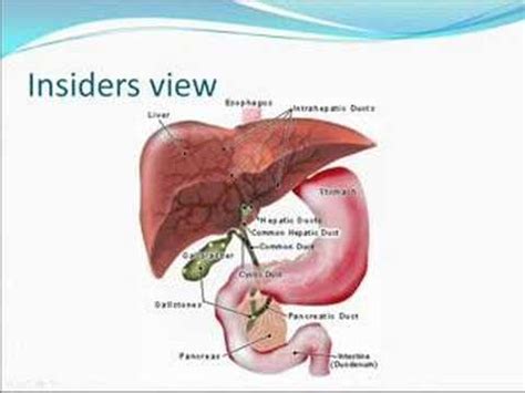 About Primary Sclerosing Cholangitis By PSC Trust YouTube