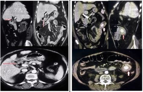 Acta Scientific International Open Library Open Access Journals Publishing Group